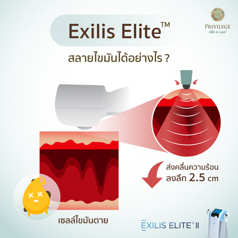 Exilis Elite Face - Privilege Clinic