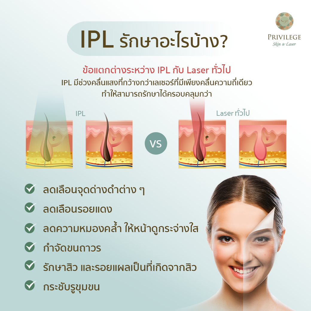 Intense Pulsed Light - Privilege Clinic