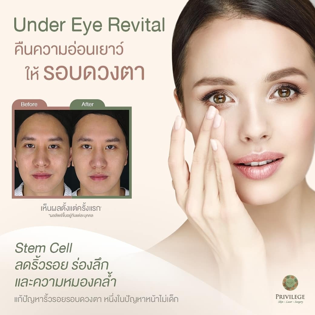 Under Eye Revital - Privilege Clinic