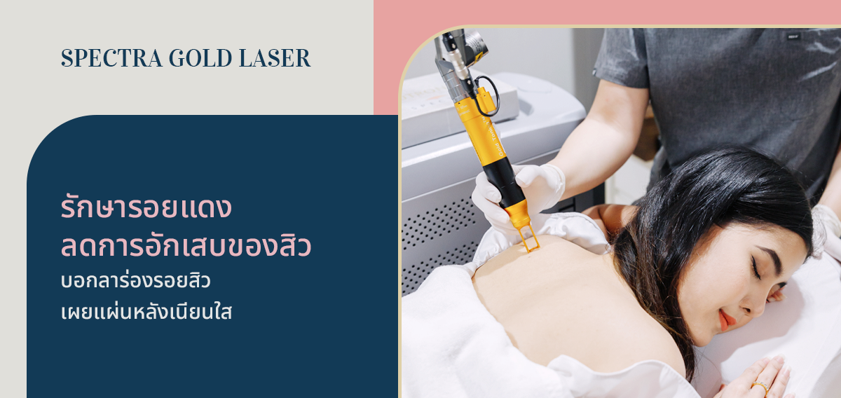 Spectra Gold Laser - Privilege Clinic