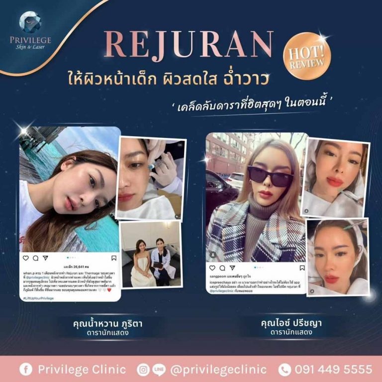 Before After - Privilege Clinic