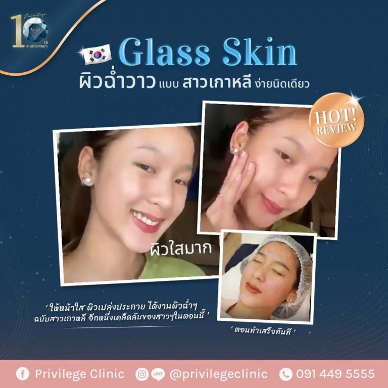 Before After - Privilege Clinic